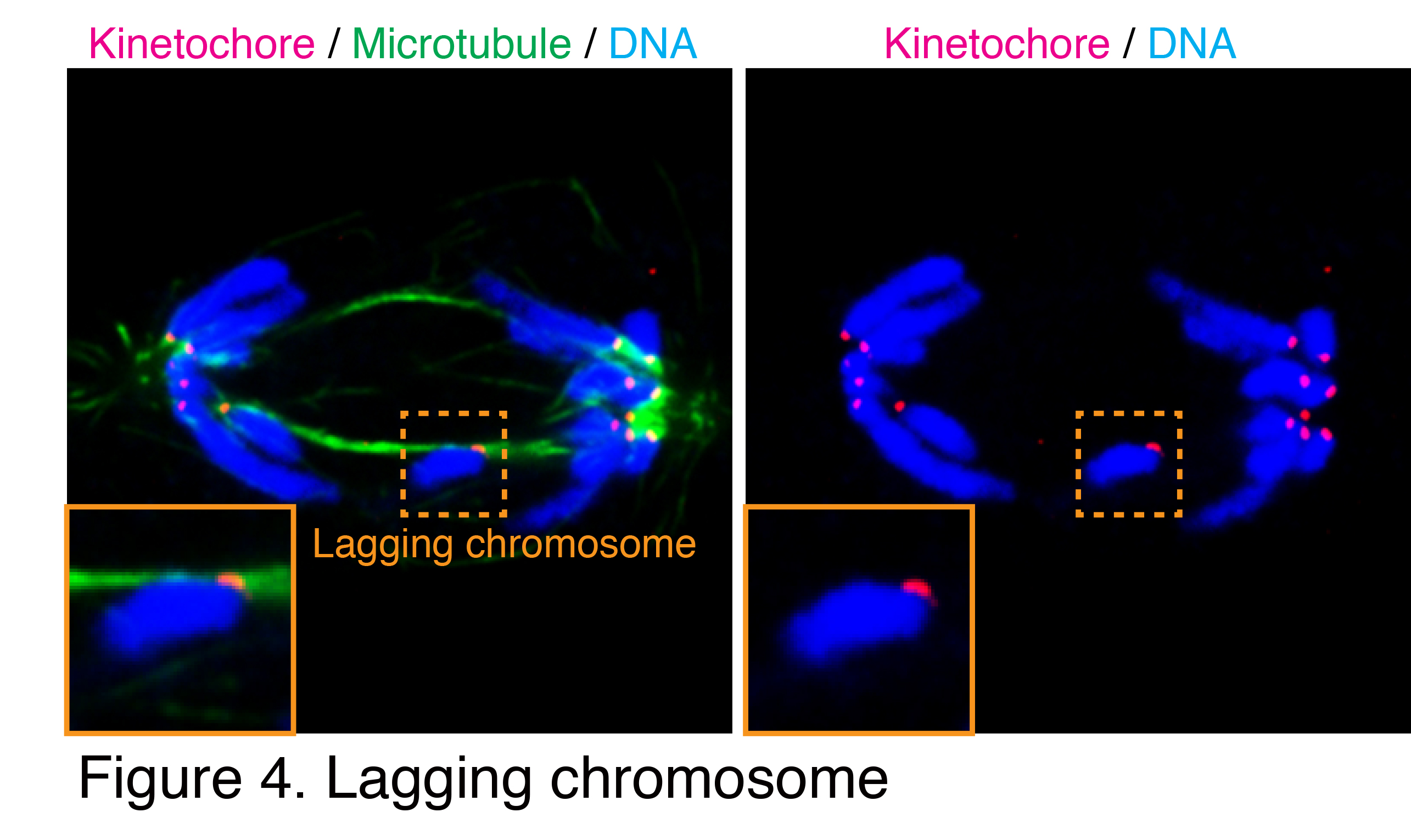 Kinetochore/Centromere Integrity and Cancer – Suzuki Lab – UW–Madison
